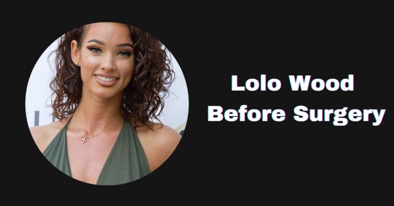 Lolo Wood Before Surgery, Net Worth, Age, Family
